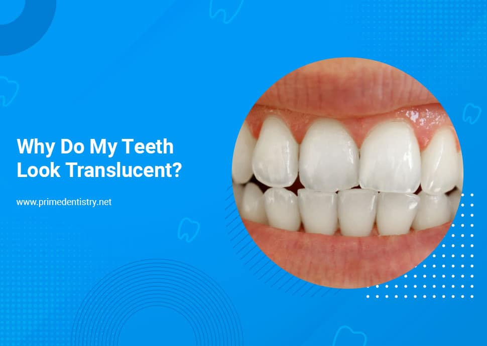 What to do if a Dental Abscess Bursts on its Own (4 Tips) – Prime Dentistry