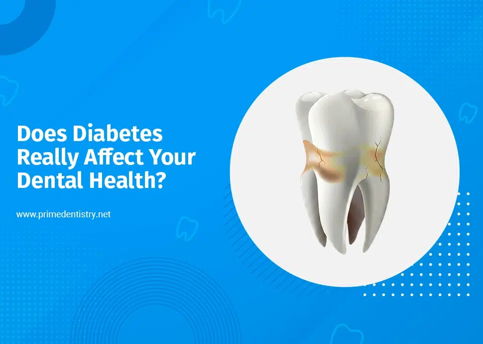30+ Soft Foods to Eat After Tooth Extraction – Prime Dentistry